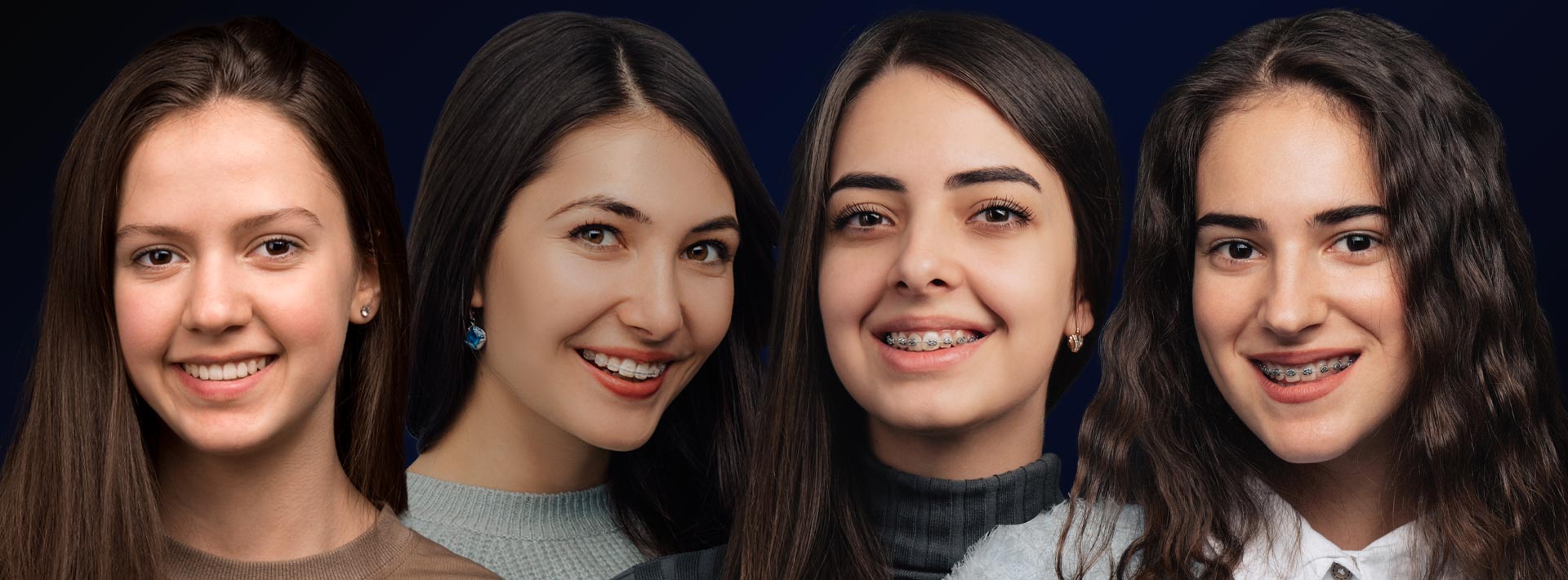 Brackets Chisinau în rate. Tratament ortodontic| Dentus Dentino